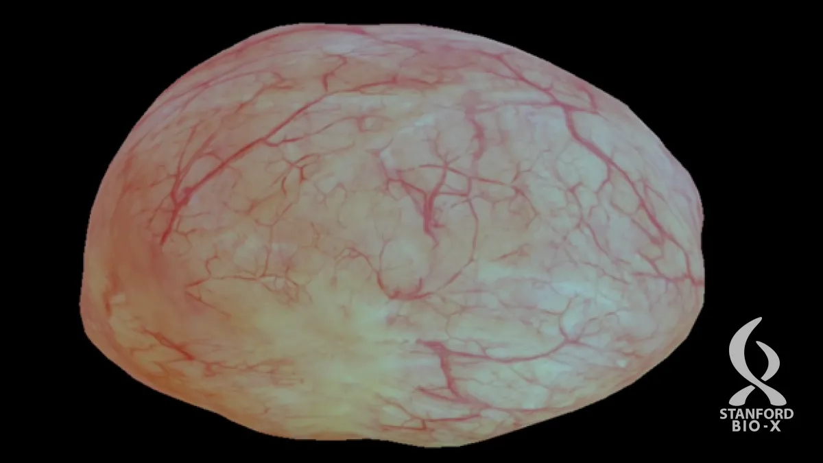 Stanford scientists create three-dimensional bladder reconstruction ...
