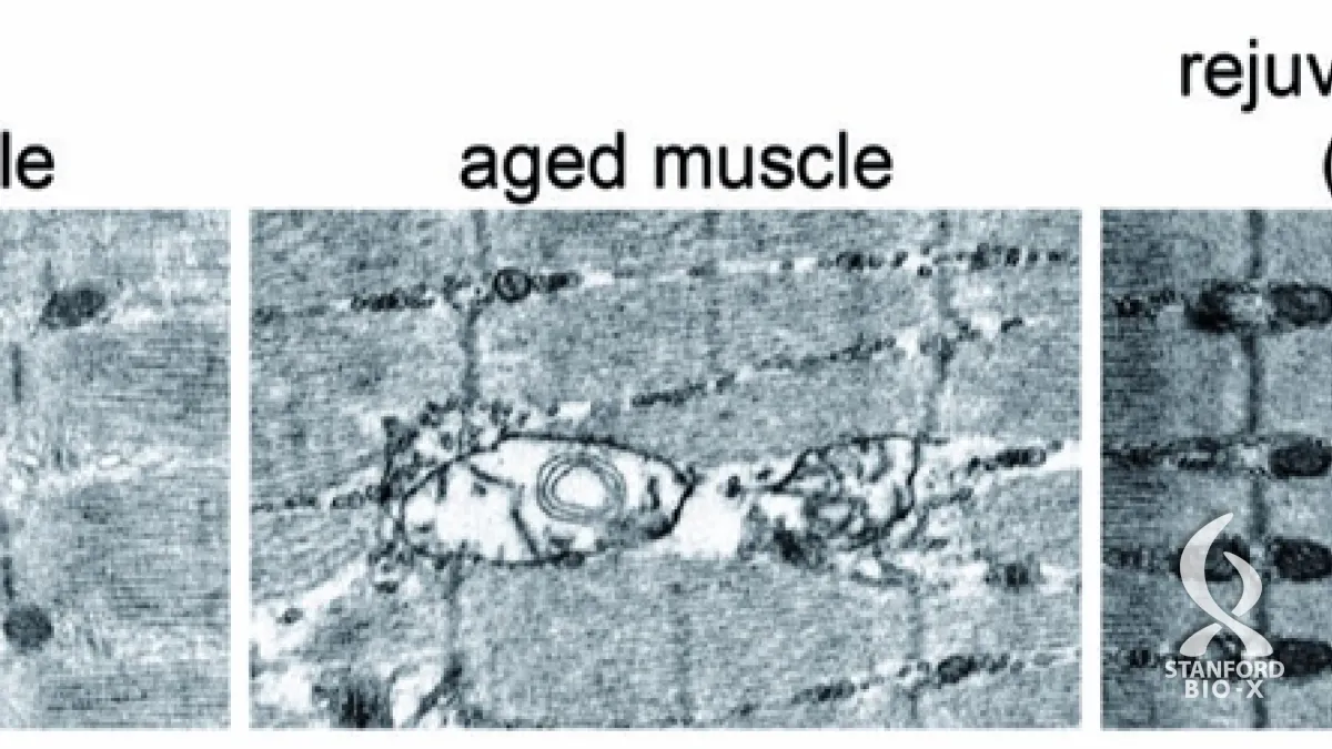 Small molecule restores muscle strength, boosts endurance in old mice ...
