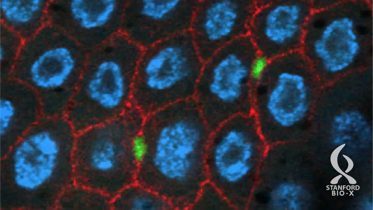 Micro-balloons designed by Stanford Bio-X researchers could reveal how ...