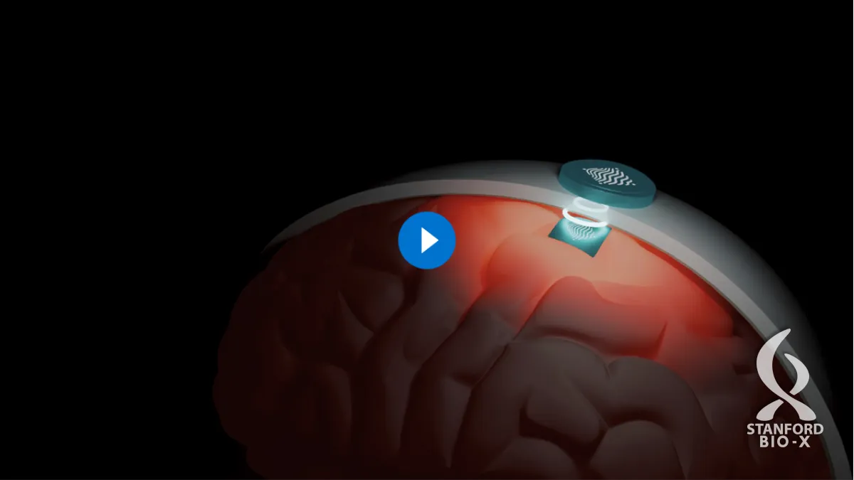 Silicon Chips on the Brain: Researchers Announce a New Generation of ...