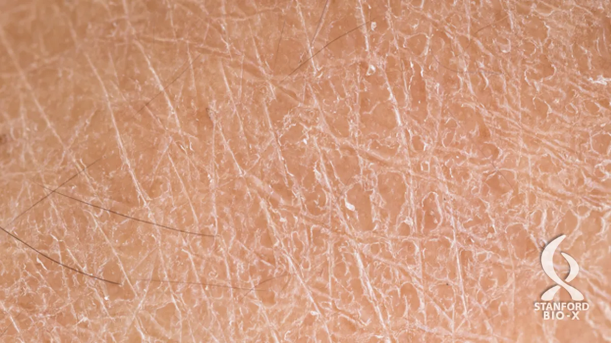 Stanford Medicine magazine shows some skin — and all its complexity ...