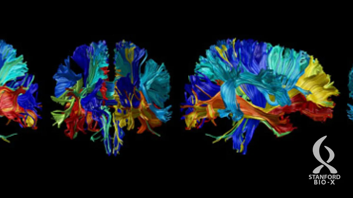 Stanford scientists track the rise and fall of brain volume throughout ...